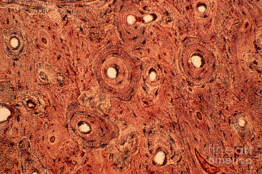 Compact Bone Slide Histology Slides 1